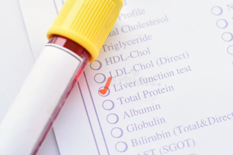 136 Liver Function Test Stock Photos - Free & Royalty-Free Stock Photos ...