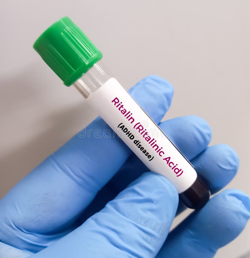 Blood Sample for Methylphenidate or Retalin Test. Stimulant Used for ...