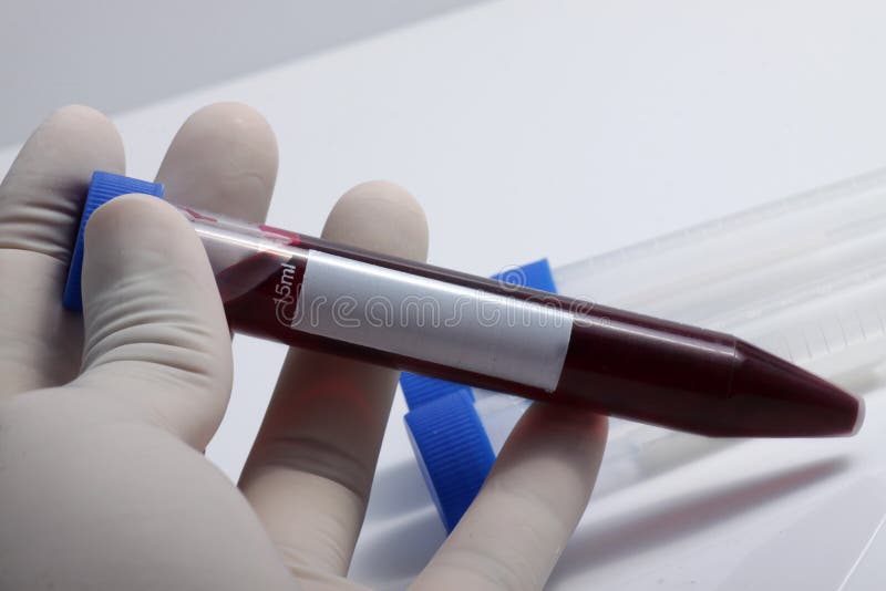 Blood Sample from Patient Placed into Test Tube Stock Image - Image of ...