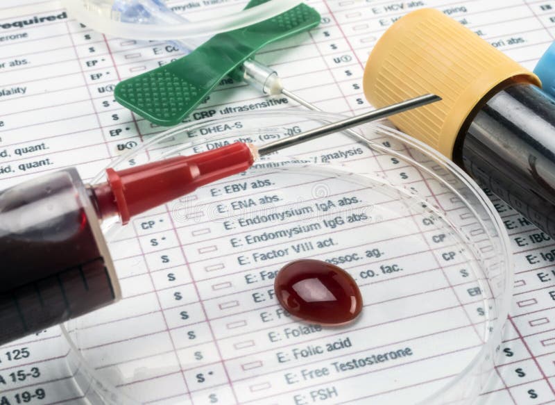 Blood Sample on a Petri Disc Along with Syringe in a Laboratory Stock ...