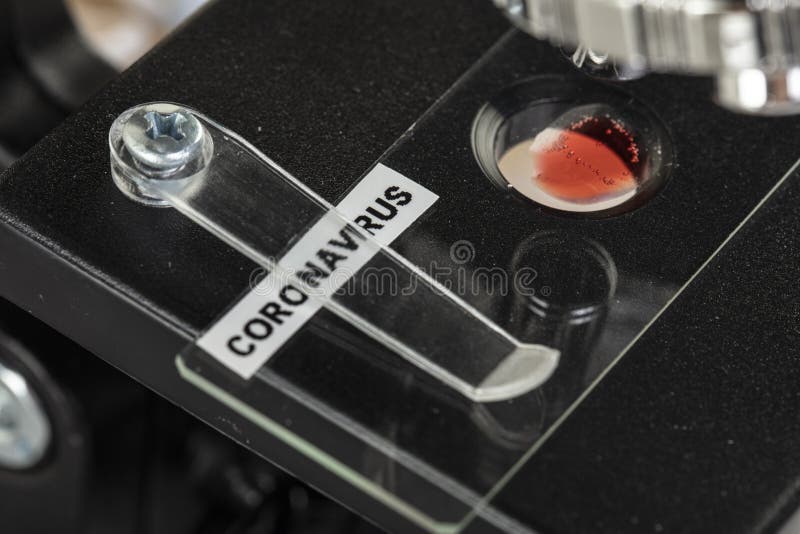 Blood Sample Placed on a Microscope Slide Stock Image - Image of ...