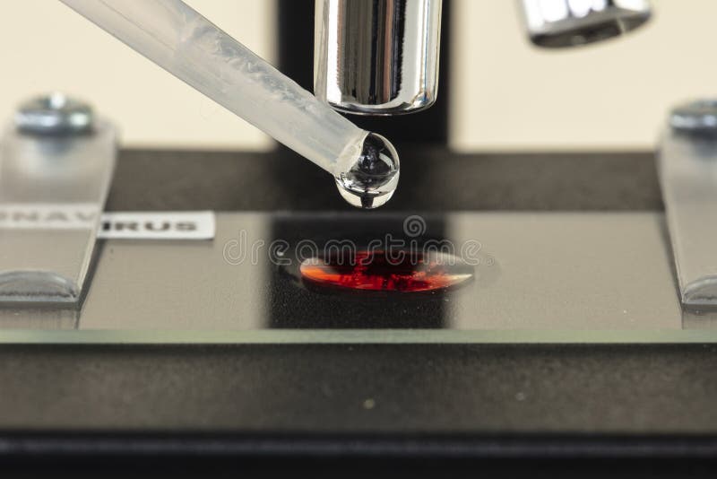 Blood Sample Placed on a Microscope Slide Stock Photo - Image of ...