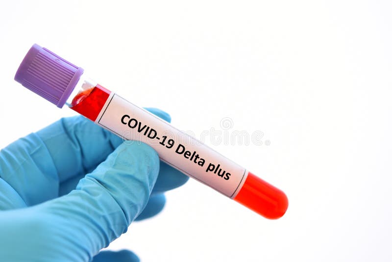 Blood Sample Positive with Delta Plus COVID-19 Stock Photo - Image of ...