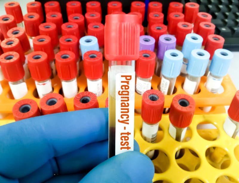 Blood Sample for Pregnancy Test in Laboratory Stock Photo - Image of ...