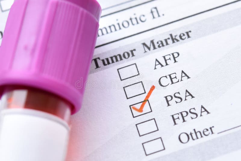 Diagnosis of Prostate Adenoma. Medical Concept Picture of Diagnosis ...
