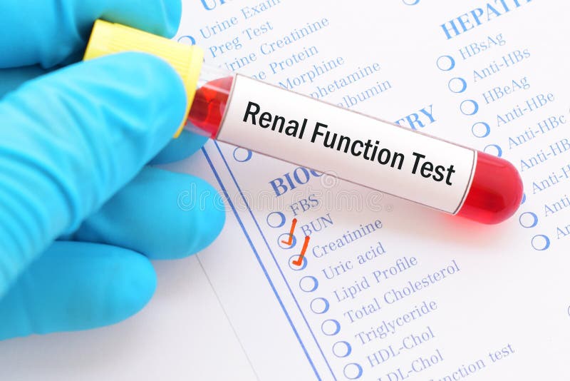 Renal function test stock image. Image of technology - 102159889
