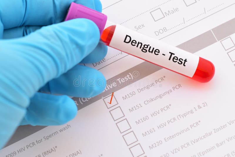 Dengue Virus Positive Test Result Stock Photo - Image of cassette ...