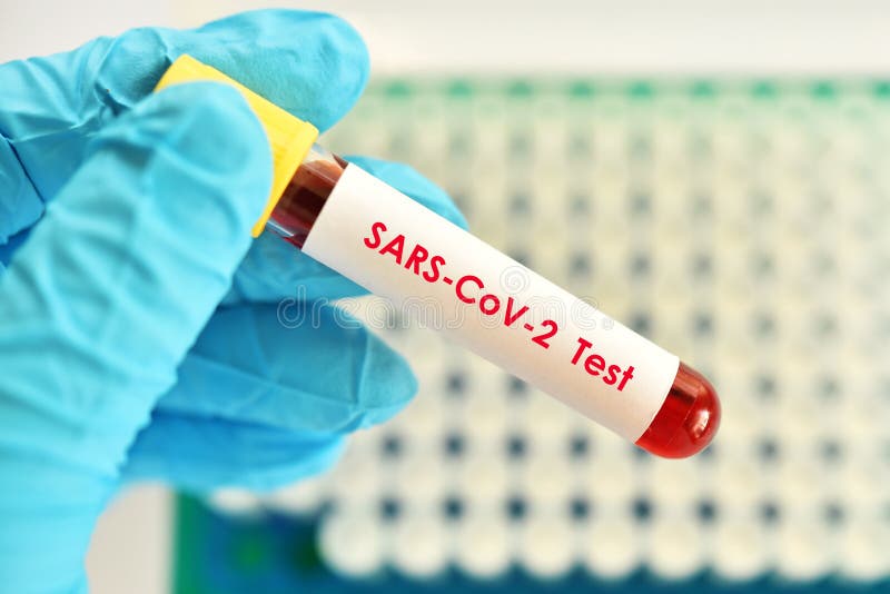 Blood Sample for SARS-CoV-2 Test Stock Photo - Image of corona ...