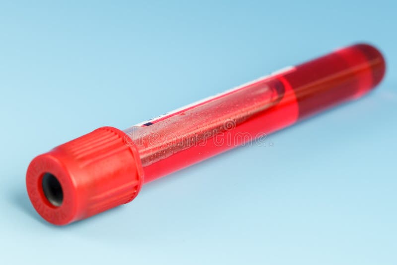 Blood sample stock photo. Image of genetic, chemical - 30444372