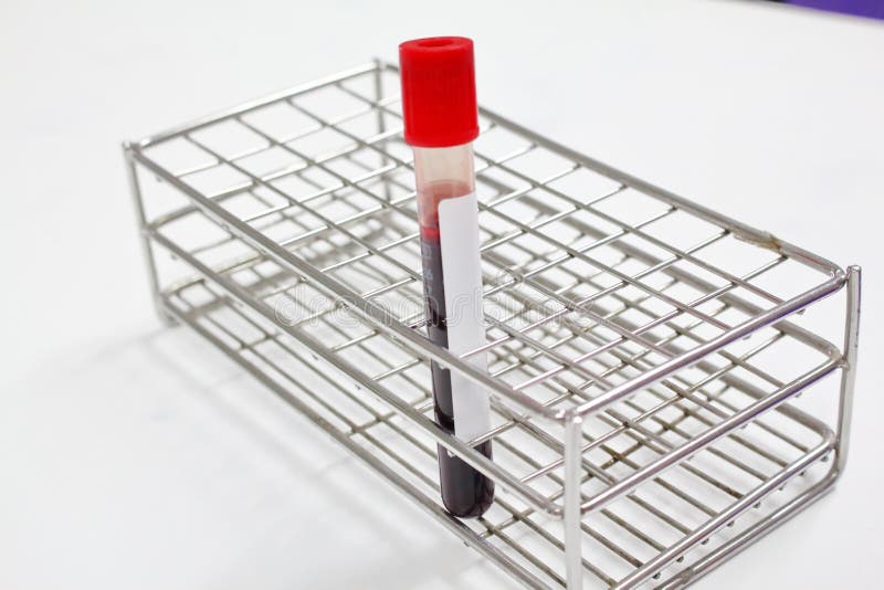 Blood Sample in a Test Tube Vacutainer Stock Image - Image of cells ...