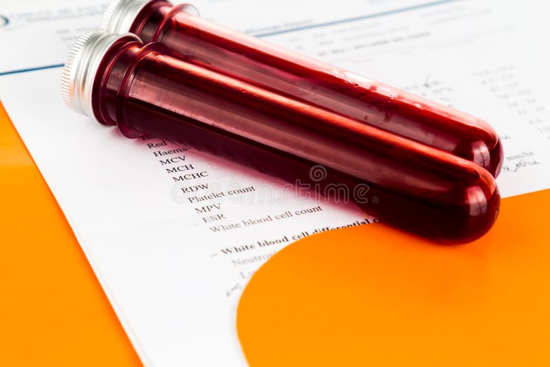 Blood Sample in Test Tubes with Health Analysis Screening Report Stock ...