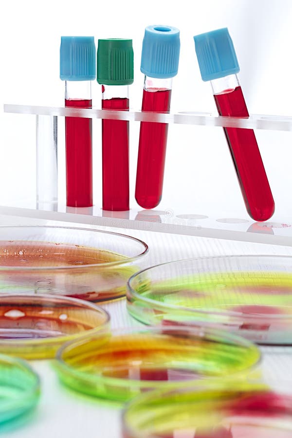Blood Sample in Test Tubes and Petri Dishes Stock Photo - Image of help ...