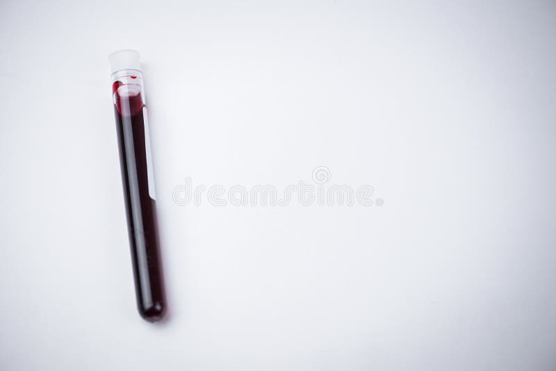 Blood Sample Test Tubes on White Background , Blood Sample for COVID-19 ...