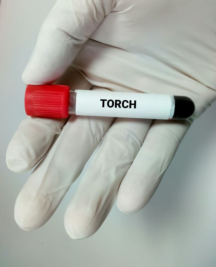 Blood Sample for TORCH Test. TORCH Panel Stock Photo - Image of ...