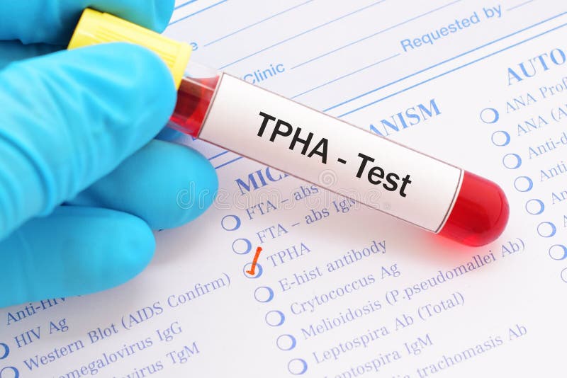 Tpha Stock Photos - Free & Royalty-Free Stock Photos from Dreamstime