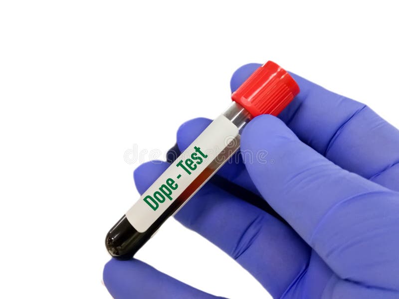 Blood Sample Tube for Dope Test. Stock Image - Image of cryoglobulin ...