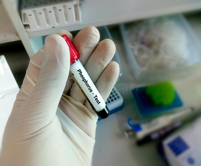 Blood Sample Tube for Phosphorus Test Stock Image - Image of medicine ...