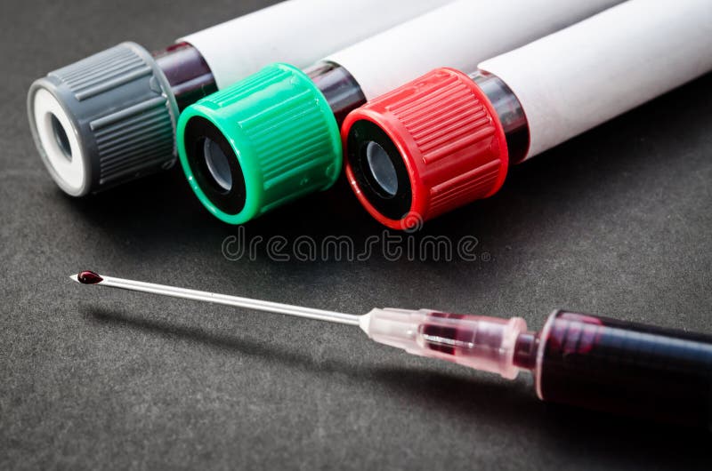 Laboratory Test Tube And Syringe With Blood Sample. Stock Photo - Image ...