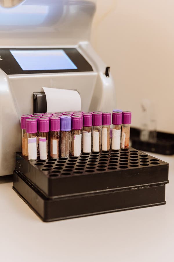 Blood Sample Tubes in a Laboratory Analyzer for Testing and Diagnostics ...