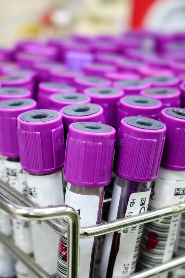 Sample tubes stock photo. Image of examine, medicine - 47167444