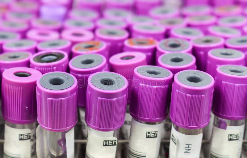 Sample Tubes for NMR Spectrometre Stock Photo - Image of ware, physical ...