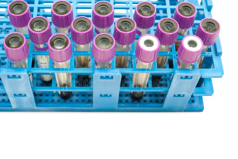 Blood Sample Tubes in Rack on White Background with Copy Space Stock ...