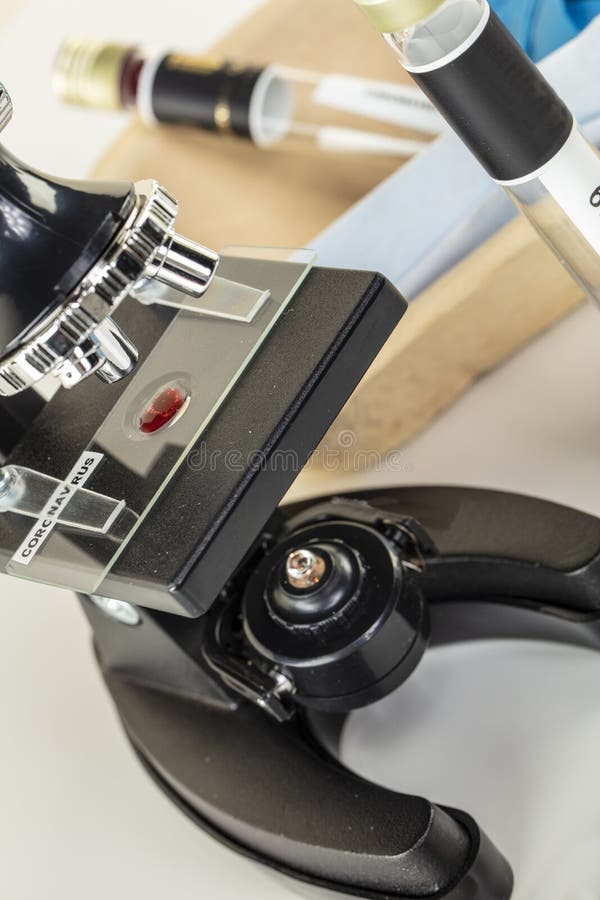 Blood Sample Under a Microscope in a Laboratory, Concept for Testing ...