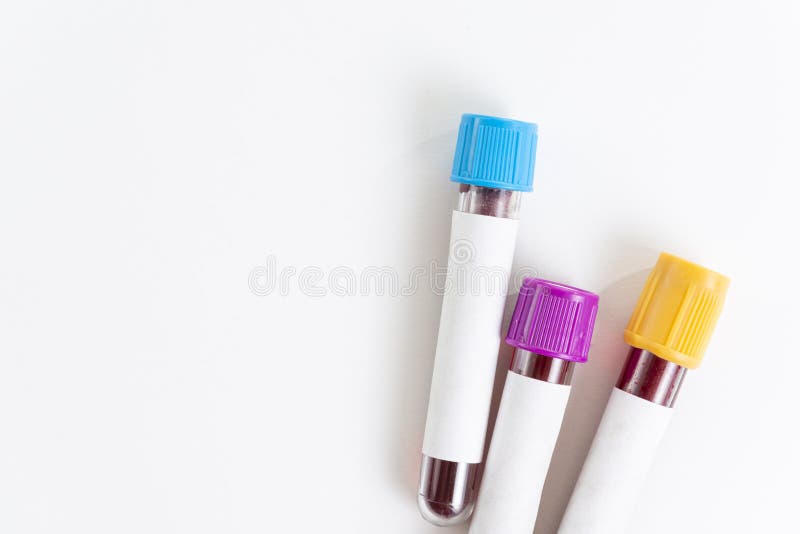 Blood Sample in Vacuum Tube Isolated on White Background. Top View ...