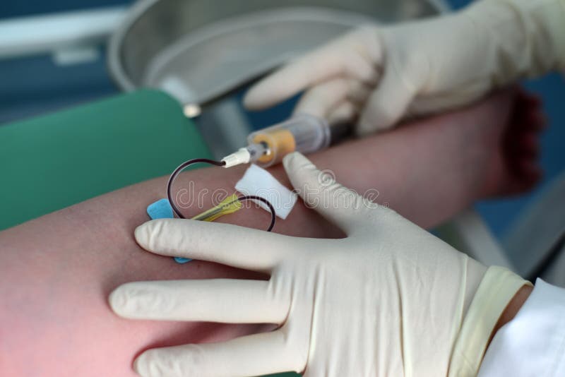 Blood Sample from a Vein in Child Stock Photo - Image of infant, brush ...