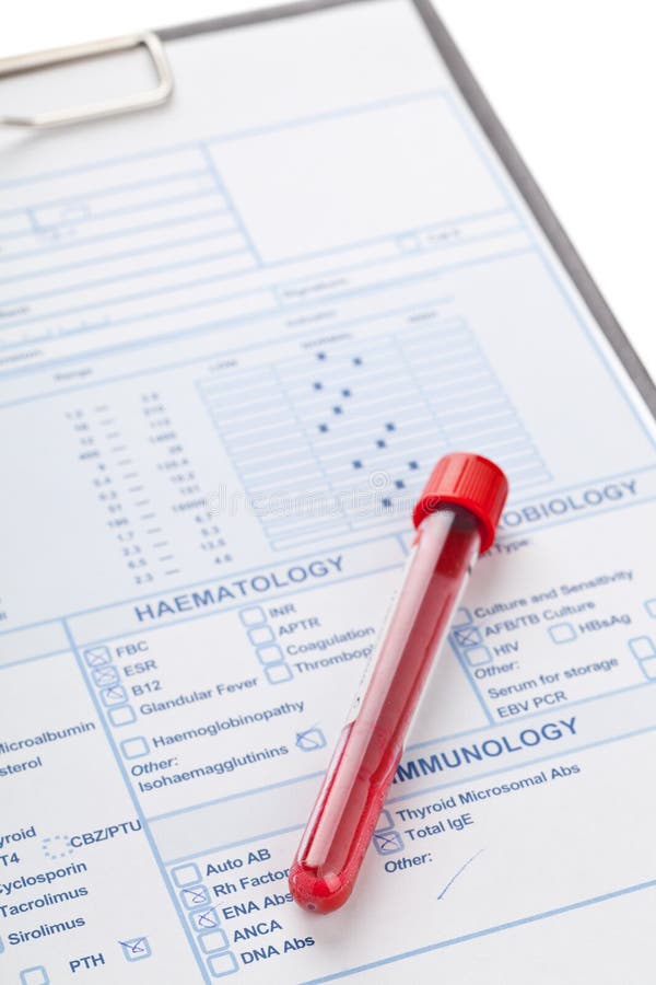 Blood sample stock image. Image of analysis, equipment - 38637627