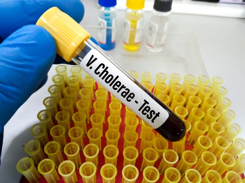 Blood Sample for Vibrio Cholerae Test Stock Photo - Image of fgf23 ...