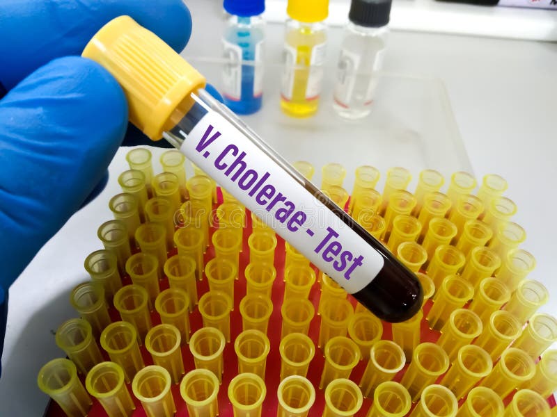 Blood Sample for Vibrio Cholerae Test Stock Photo - Image of fibroblast ...