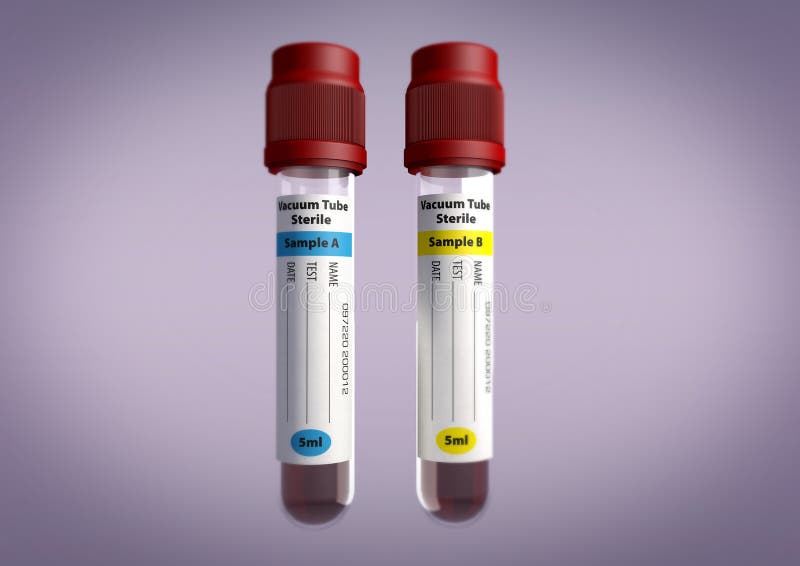 Blood sample viles stock illustration. Illustration of screening ...