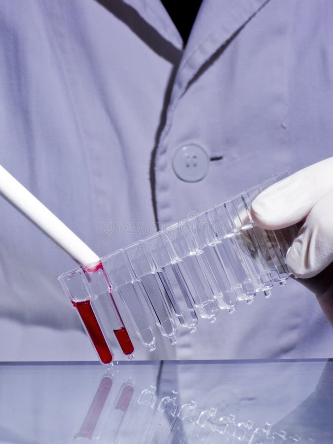 Blood samples stock image. Image of blue, doctor, pipette - 3872639