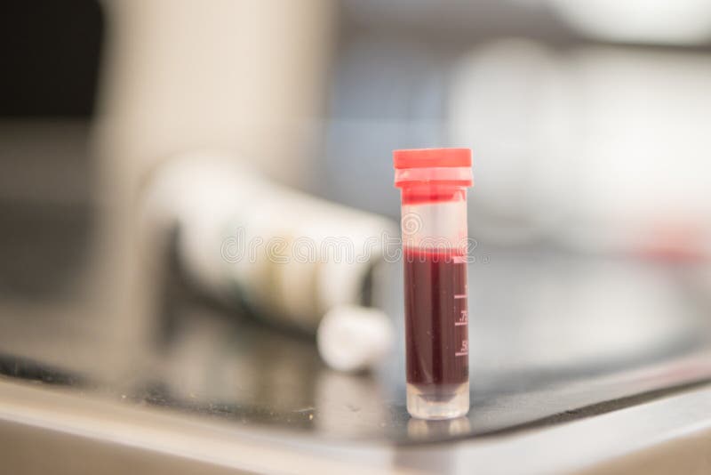 Blood Samples for Analysis in a Test Tube Stock Photo - Image of glass ...