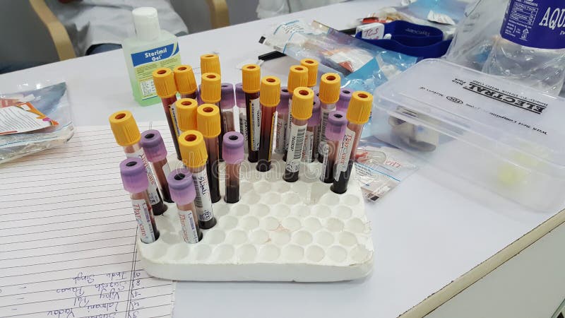 Vials Of Blood For The Laboratory Stock Photo - Image of test ...