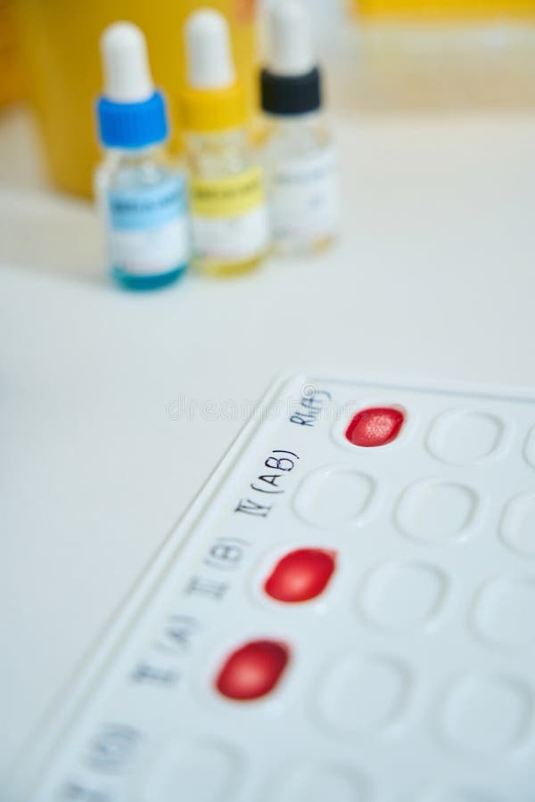 Blood Samples on an Indicator Palette are on Laboratory Table Stock ...