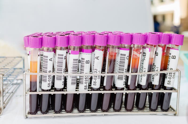 Blood samples stock image. Image of beaker, microbiology - 51575263