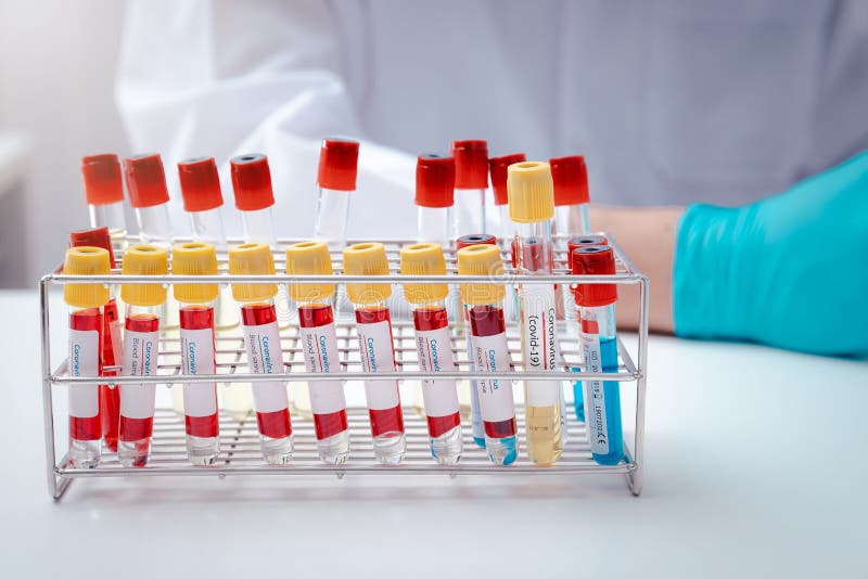 Blood Samples and Plasma in Tubes on Work Table in a Medical ...