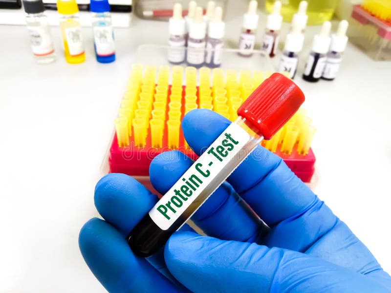 Blood Samples for Protein C Test with Laboratory Background. Stock ...