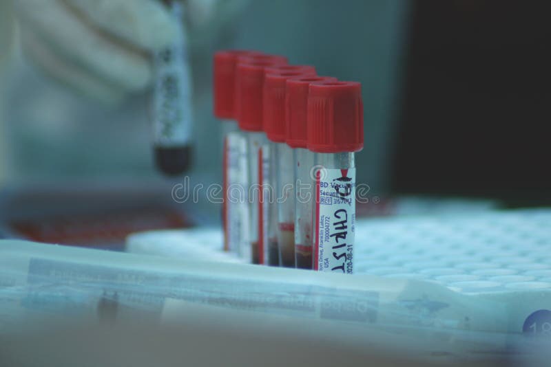 Blood Samples are Stored on a Laboratory Table. Covid-19 Test Editorial ...