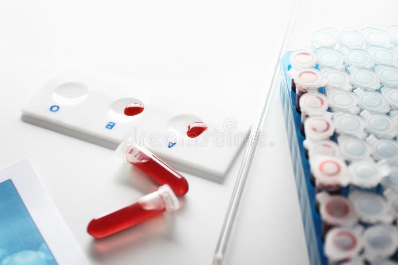 Blood Samples on Table in Laboratory Stock Photo - Image of ...