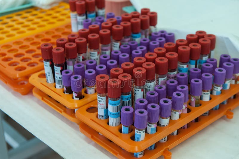 Blood Samples in Test Tubes at a Transfusion Station Editorial Stock ...