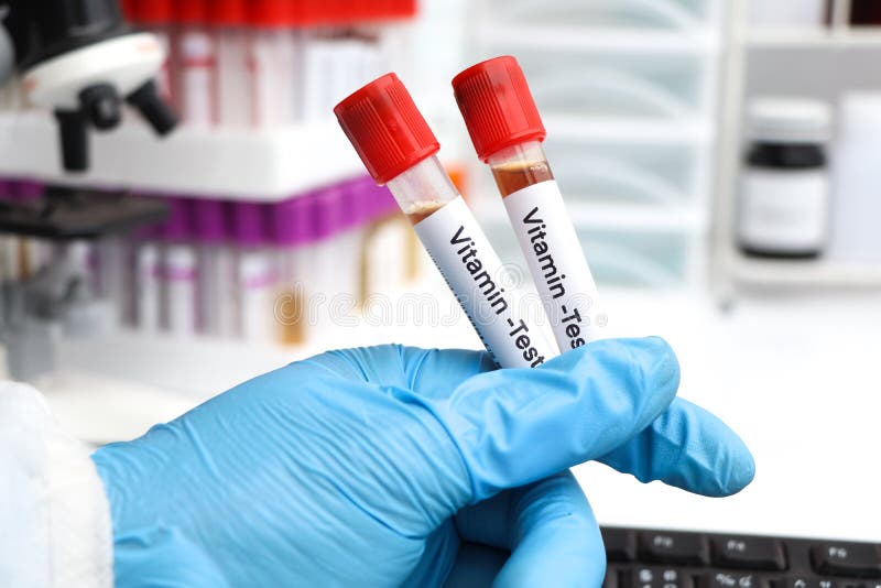 Blood Samples for Testing Vitamin in the Laboratory Stock Photo - Image ...
