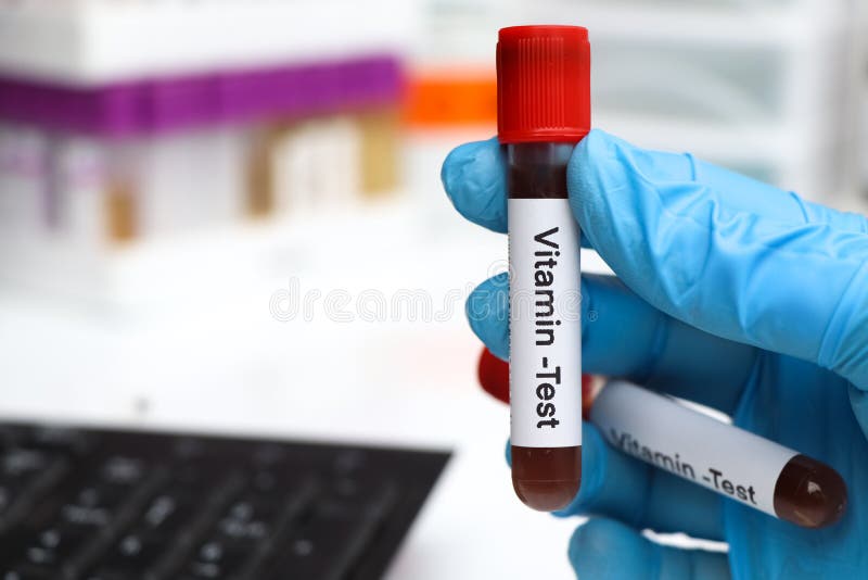 Blood Samples for Testing Vitamin in the Laboratory Stock Image - Image ...
