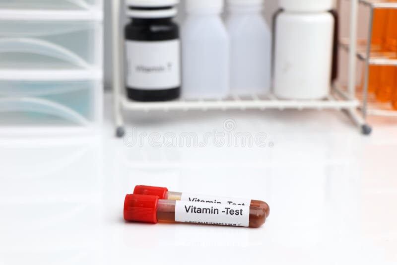 Blood Samples for Testing Vitamin in the Laboratory Stock Photo - Image ...