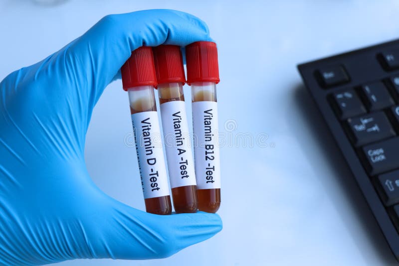 Blood Samples for Testing Vitamin in the Laboratory Stock Photo - Image ...