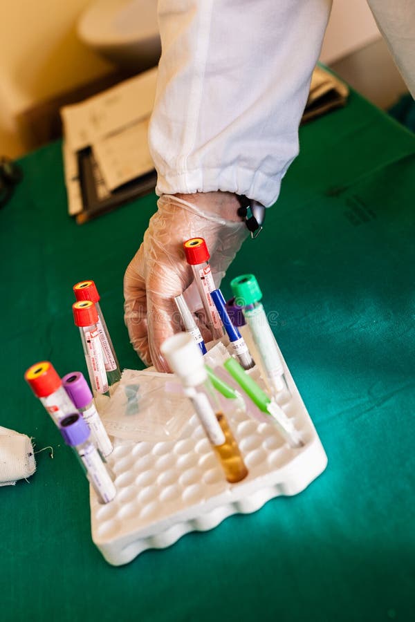 Blood samples stock photo. Image of label, hospital, bars - 45029508
