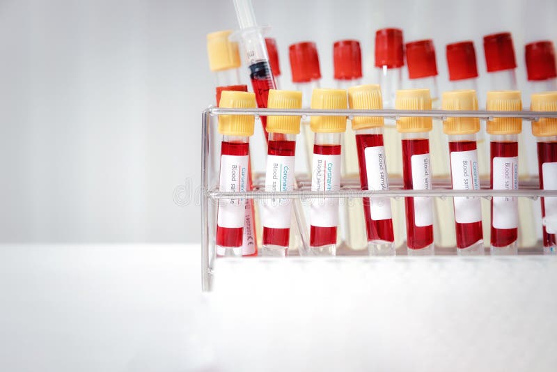 Blood Samples in Tubes and Syringes on Work Table in a Medical ...
