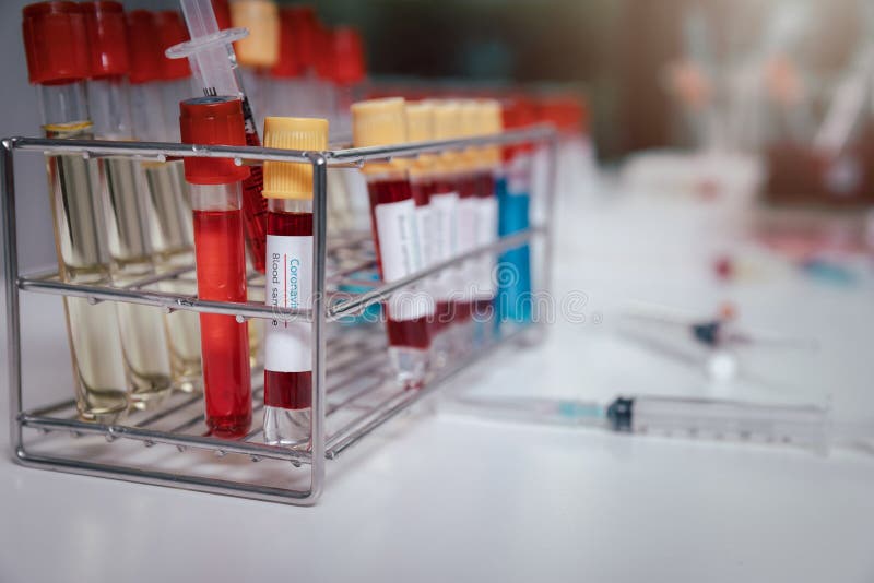 Blood Samples in Tubes and Syringes on Work Table in a Medical ...